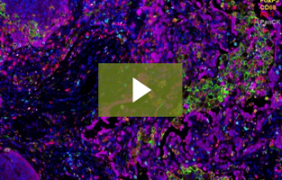 Visualizing Tissue Landscapes via Multiplex IHC